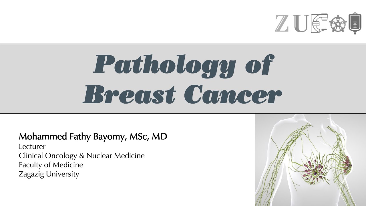 Pathology of Breast Cancer v1 video 2 of 5 - YouTube