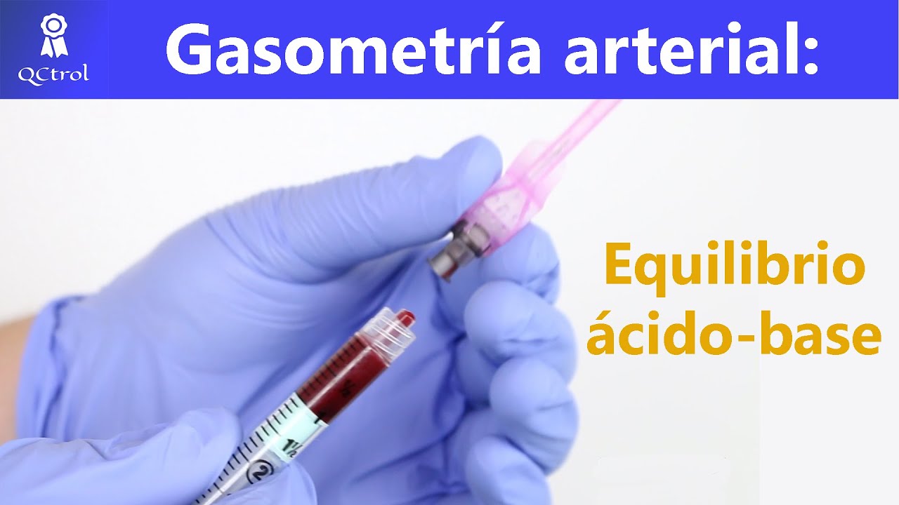 ¿Cuál es la utilidad de la GASOMETRÍA ARTERIAL? Equilibrio Ácido-Base ...