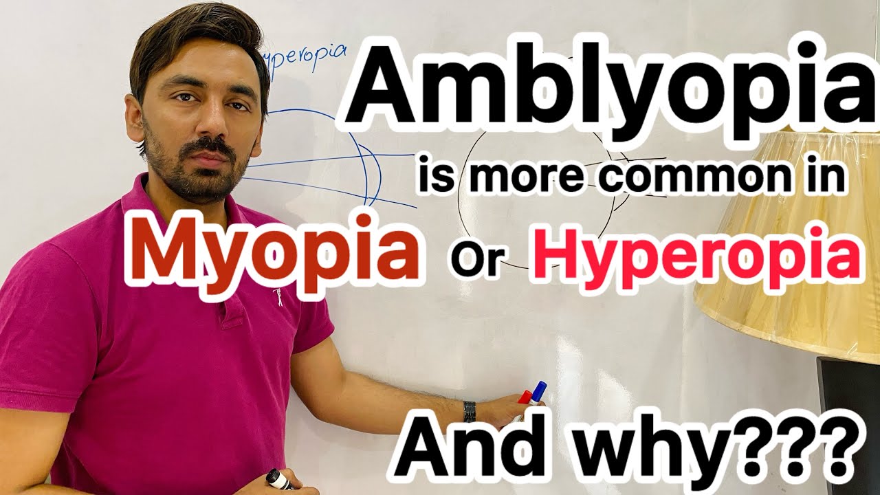 Amblyopia more common in hyperopia or Myopia and Why? - YouTube