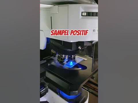 Belajar mengamati sampel positif uji FAT Rabies di lab Virologi BBVet Maros - YouTube