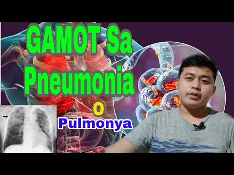 Pneumonia o pulmonya: Sanhi sintomas at gamot - YouTube