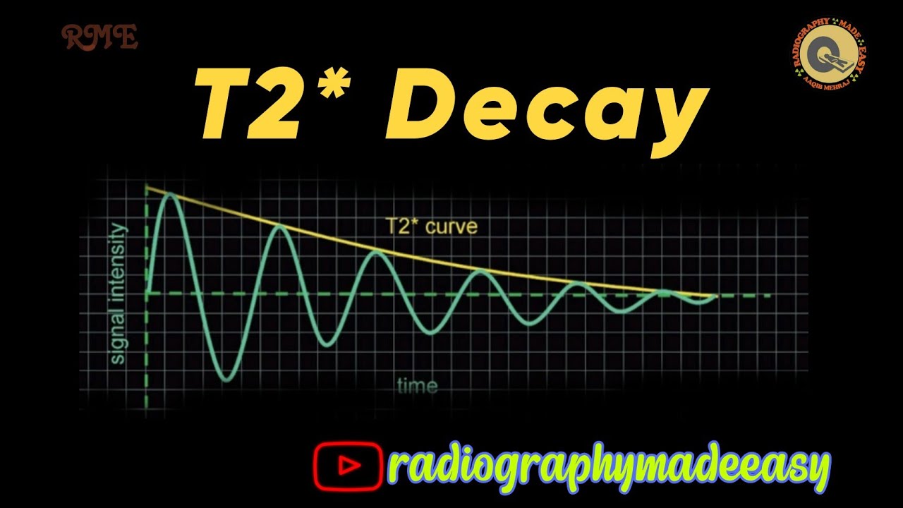 T2 * Decay Process in MRI || Causes || Graph || By Aaqib Sir - YouTube