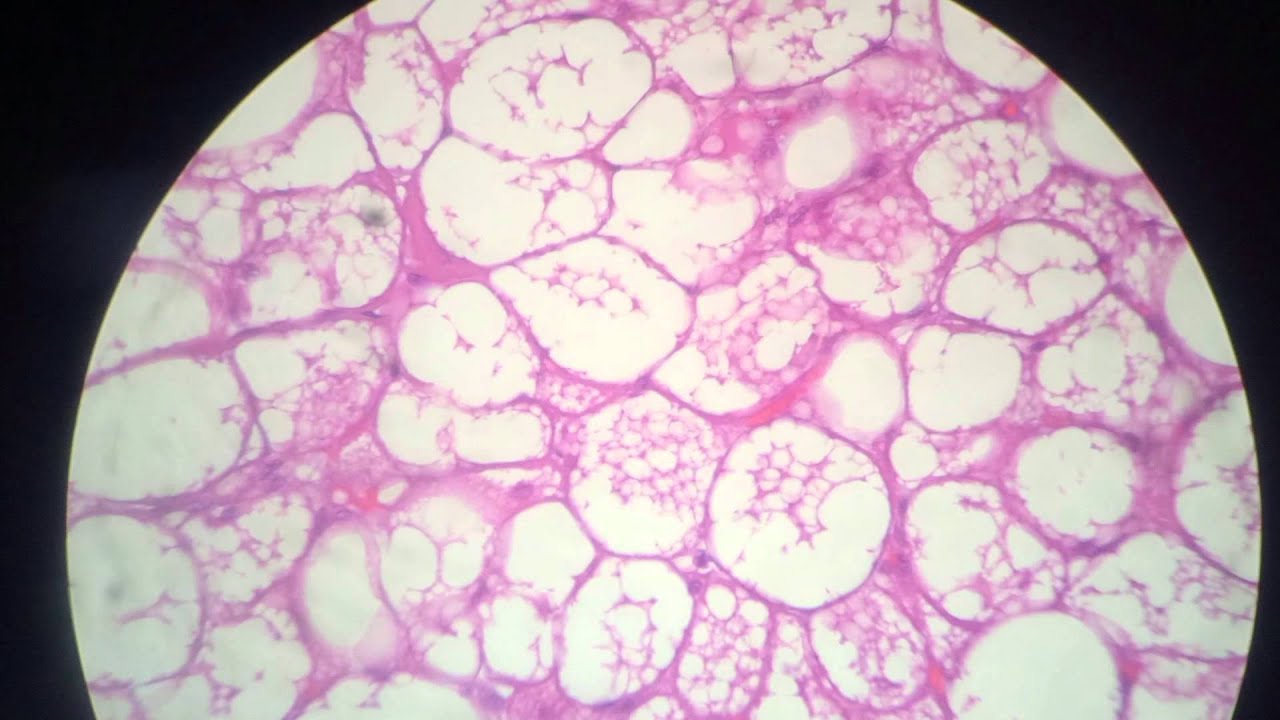 Tejido Epitelial Histología Fisioterapia IIIB: Julio 2013