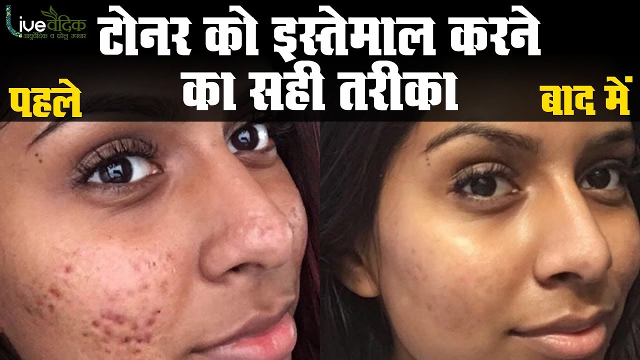 FACE TONER DIY face-toner-diy