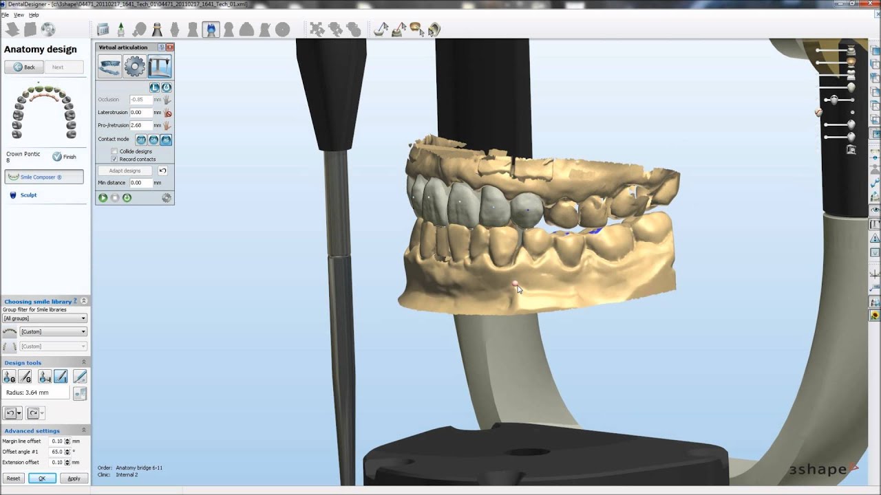 Dynamic Virtual Articulator Demo Video - YouTube