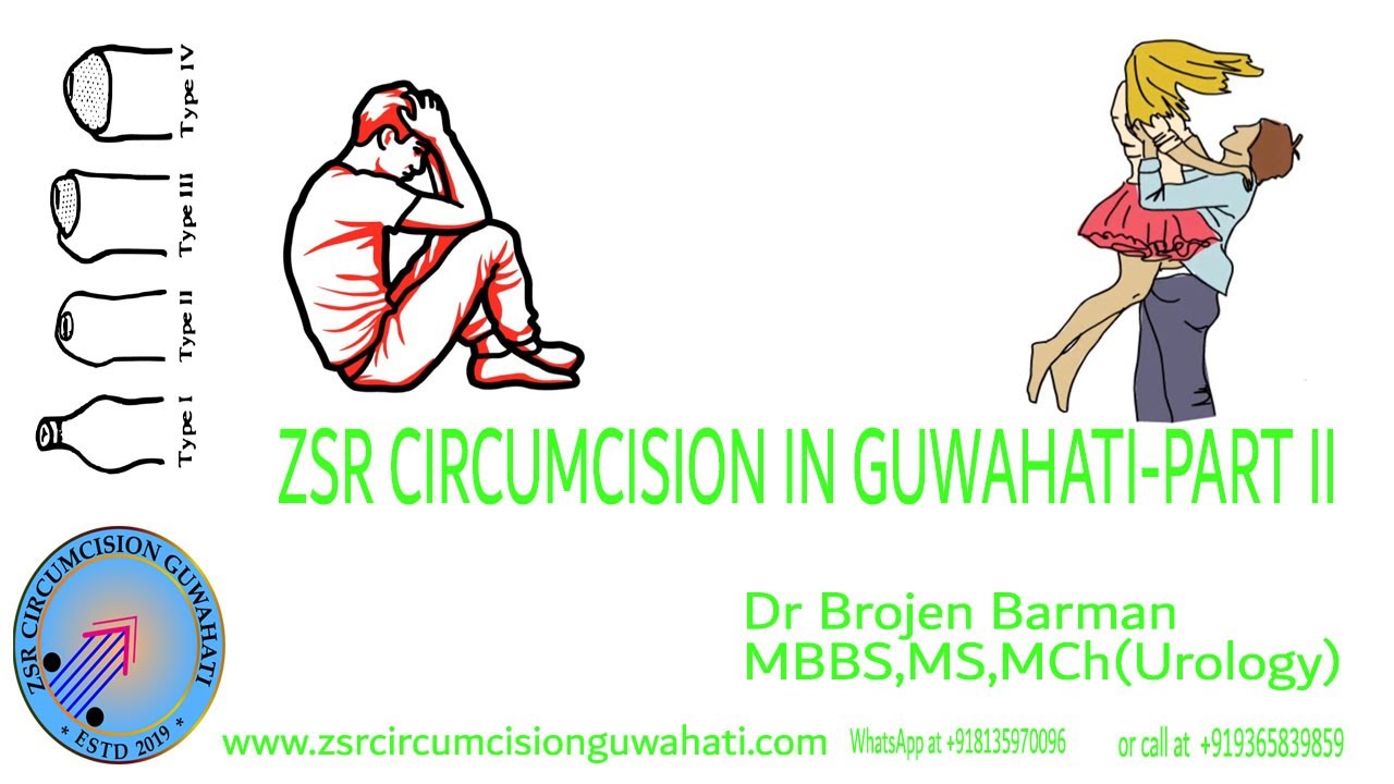 ZSR CIRCUMCISION IN GUWAHATI-PART 2| Dr Brojen Barman - YouTube