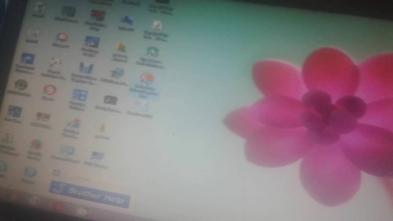 How To Input An Microscop On An Laptop From The yassen Yousef Alil How To Input An Microscop On An Laptop From The yassen Yousef Alil