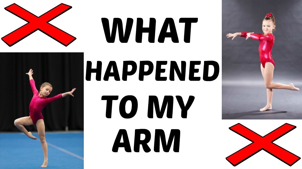 WHAT HAPPENED TO MY ARM!!? - YouTube