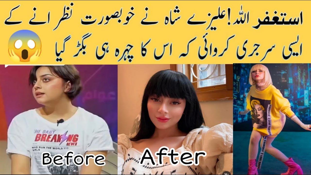 Alizeh Shah disfigured his face by undergoing surgery ||Alizeh Shah's ...