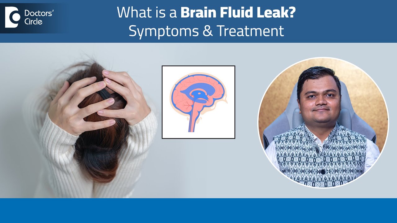 How to know if I have Brain Fluid leak?|Cerebrospinal Fluid Leak-Dr ...