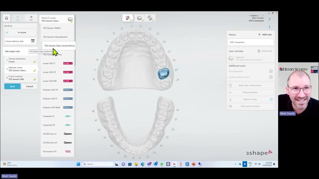 VHF Z4 with trios integration free workflow with 3shape produce. - YouTube