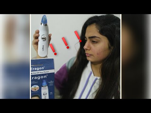Siyah Nokta Akne Temizleme Cihazı  DİKKAT❗Kardeşimin Yüzü Mahvoldu😱  Suction 40Kpa Vakumlu Cihaz