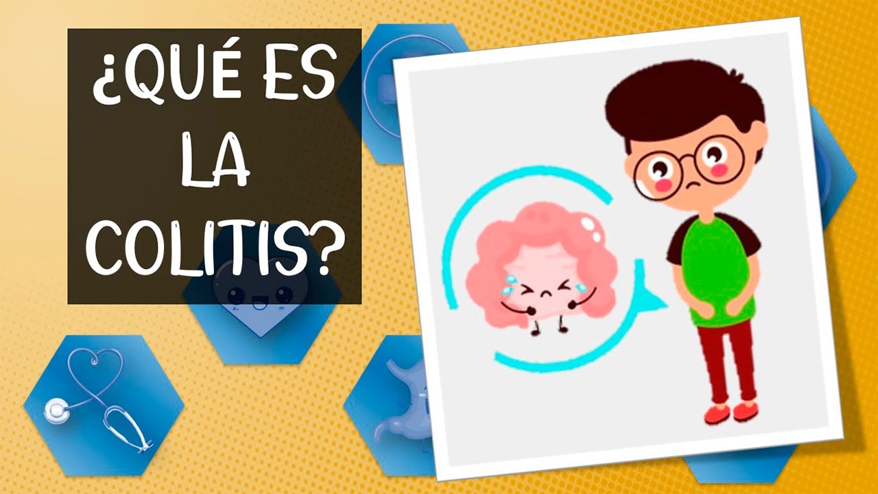 ¿Qué es la colitis? síntomas, causas, prevención, tratamiento y ...