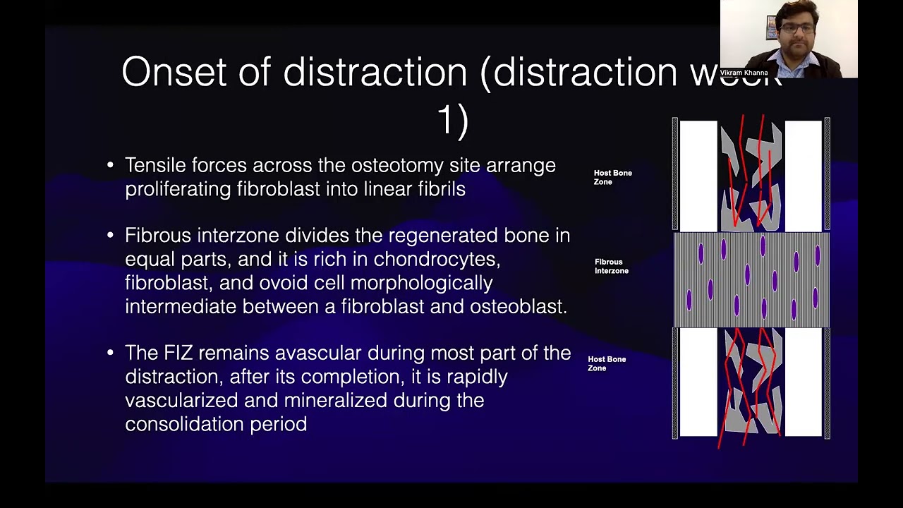 Biology of Distraction Histogenesis - Dr Vikram Khanna - YouTube