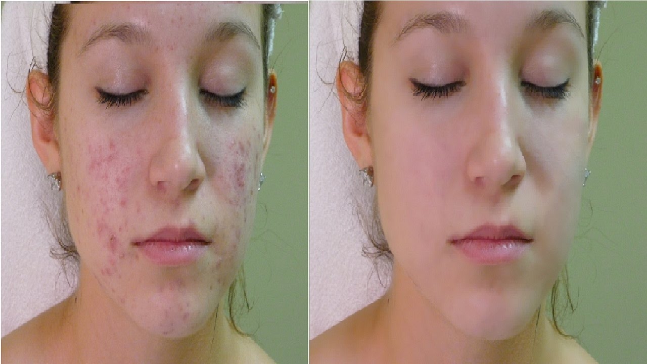 Photoshop skin retouching Before and After ★★★ - YouTube