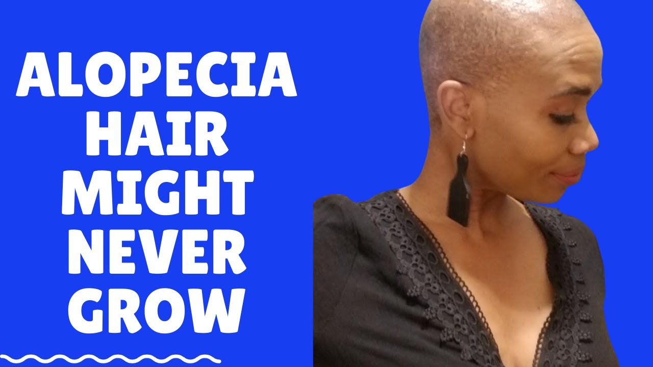 Alopecia, accepting the truth | hair might never grow back - YouTube