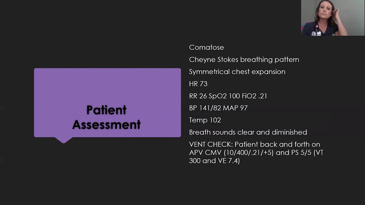 SLE Case Study - YouTube
