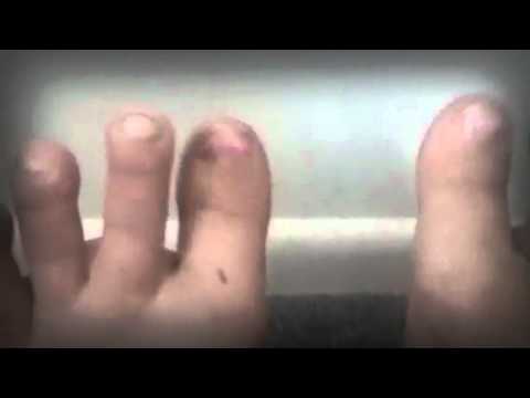 Creepy Toe - YouTube