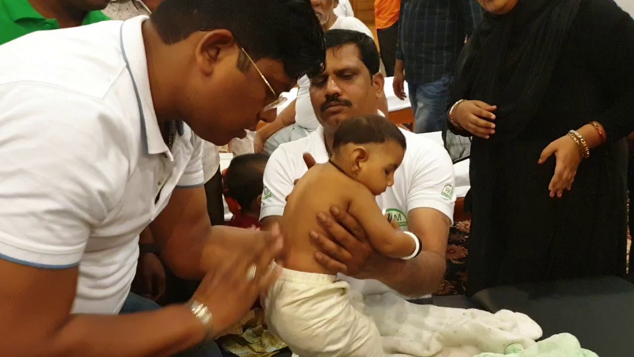 treatment for atrophy patient baby. - YouTube