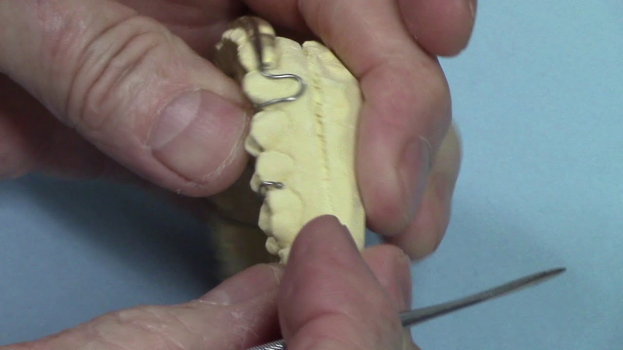 Spring Aligner - YouTube