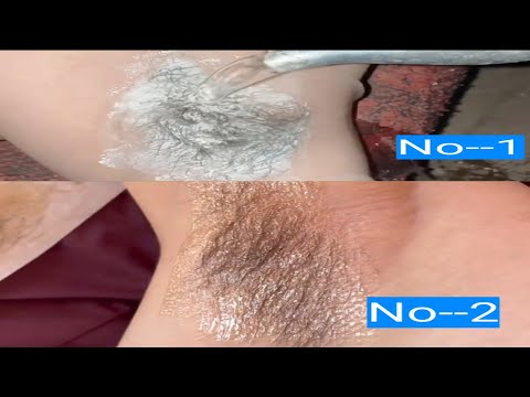 Armpit Hair Remove  Two   Types Ki😱😱