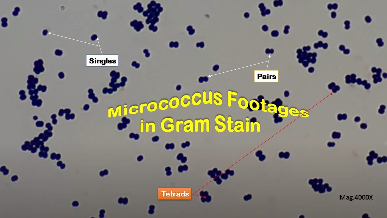 Gram positive cocci in singles, pairs and terads of Micrococcus under ...