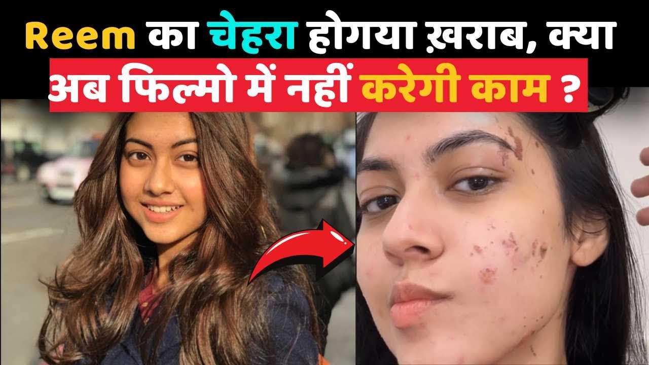 Reem Sheikh's SHOCKING INJURY on Laughter Chefs Set: Will She Take a ...