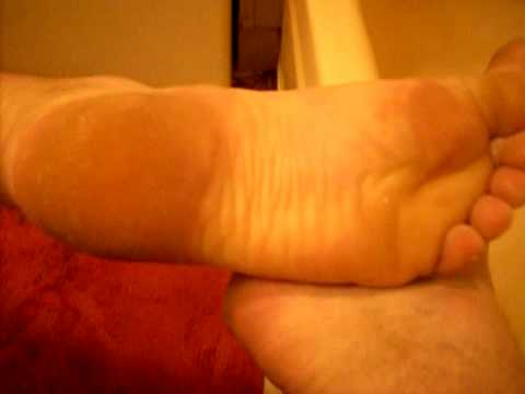 I expose my soles