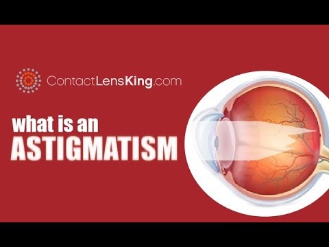 Astigmatism Explained - What is an Astigmatism and How is it Treated ...