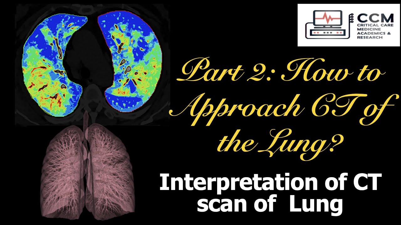Interpretation of CT Lung: Part 2 - The Approach - YouTube