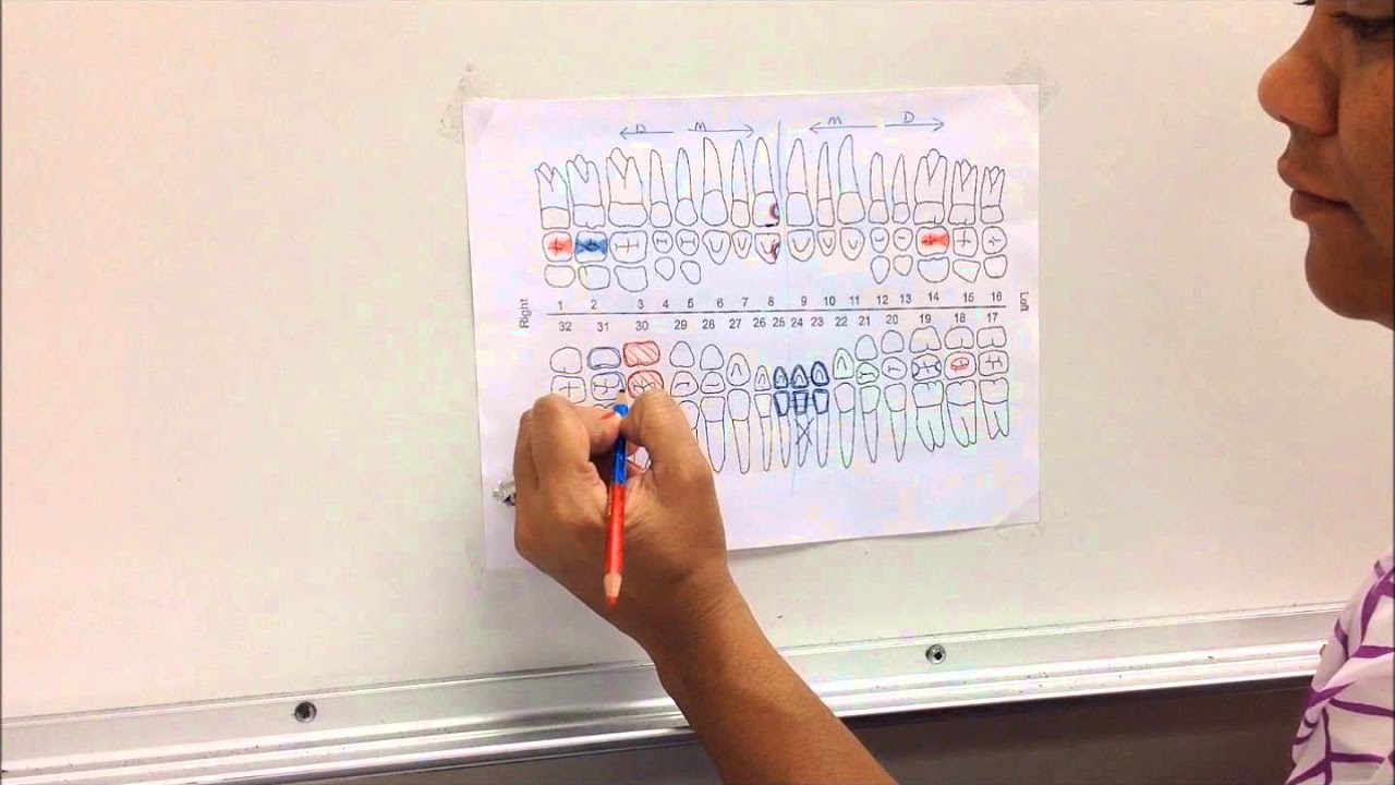 Dental Charting Symbols Cheat Sheet: The Ultimate 2024 Guide ...