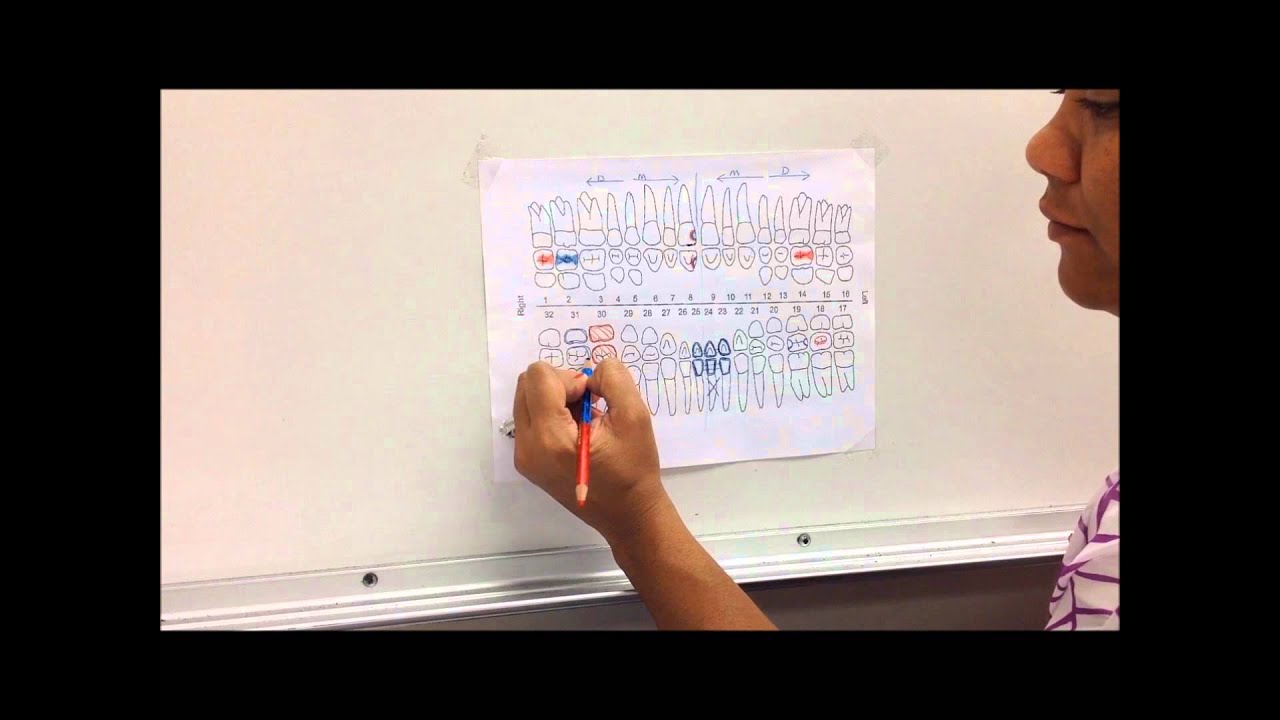 Instructional Charting Video - YouTube