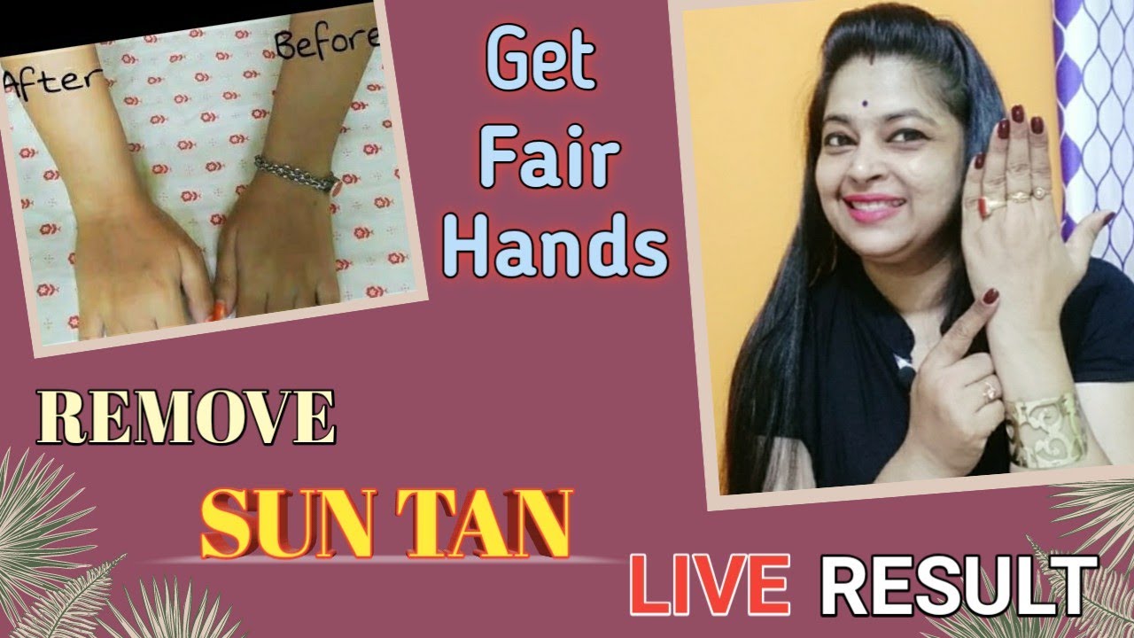 Sun Tan Removal Home Remedy For Hands | Instant Hand Whitening ...