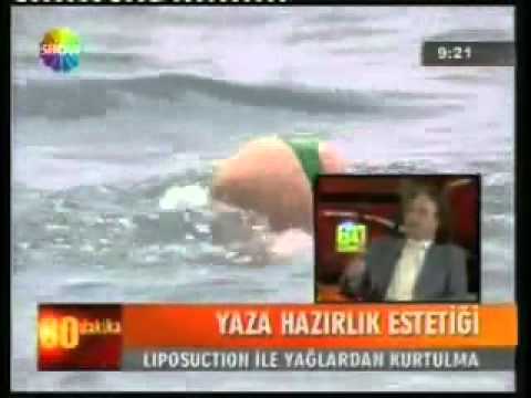 Liposuction Ameliyatı