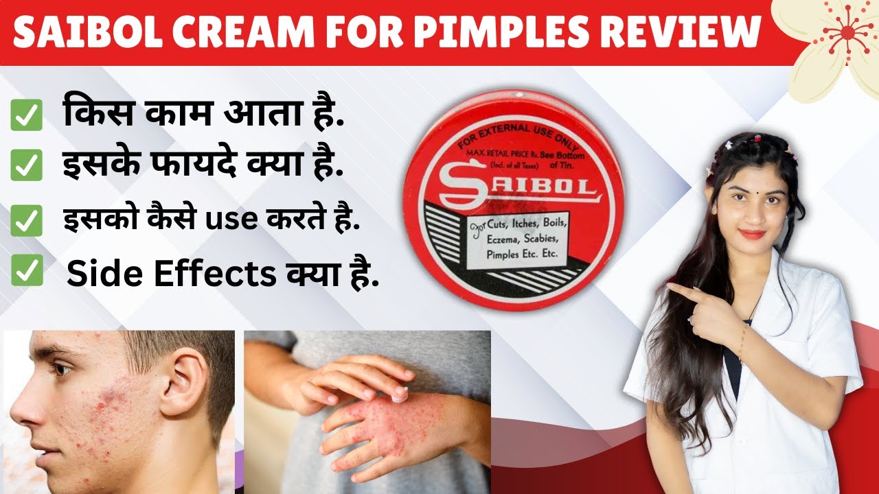 Saibol Cream for Pimples | Saibol Cream Uses in Hindi | Saibol Skin ...