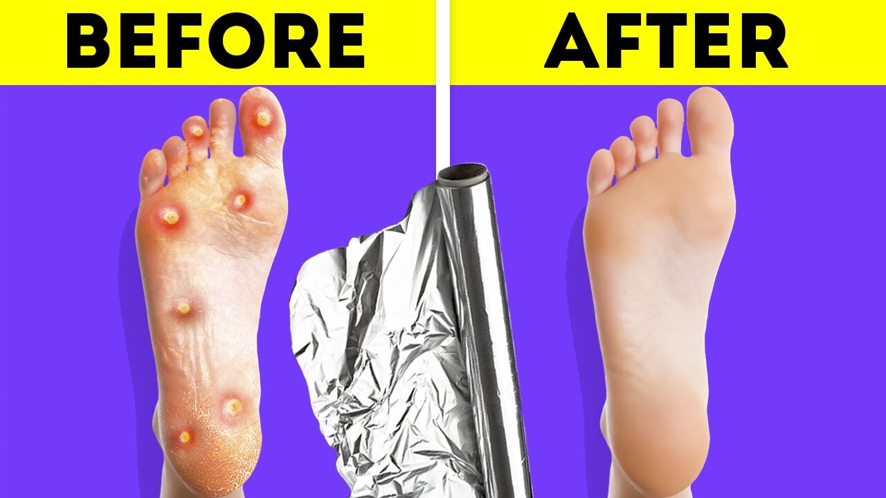 Amazing Feet Hacks And Tricks You Should Try - YouTube
