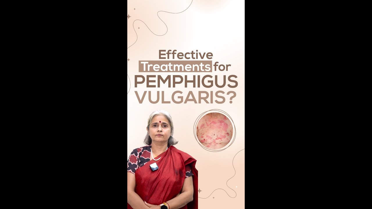 Effective Treatments for Pemphigus Vulgaris! - YouTube