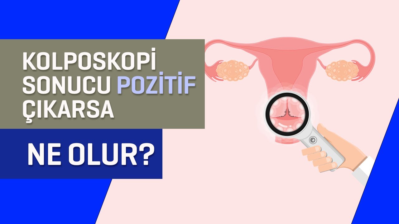 Kolposkopi Nedir? Nasıl Yapılır? Kolposkopi Sonucu Pozitif Çıkarsa Ne ...