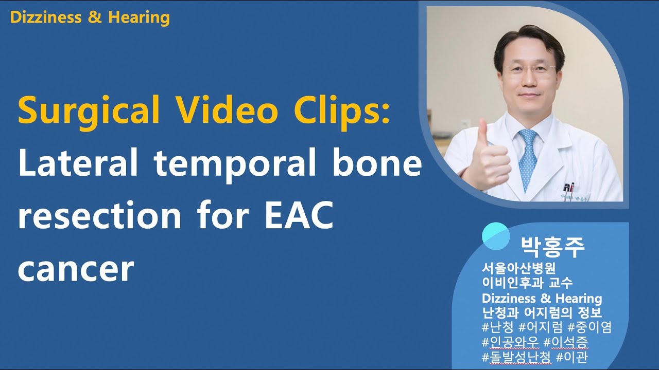 Surgical video clips_Lateral temporal bone resection - YouTube