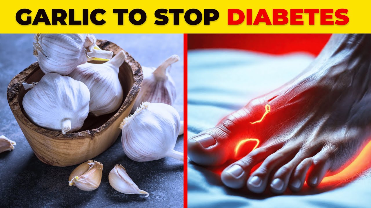 Use Garlic This Way To Stop Diabetes - YouTube