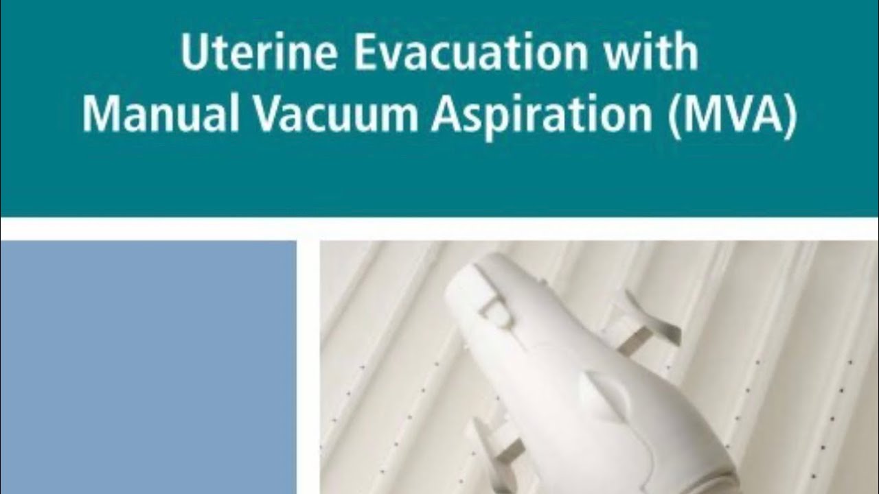 MANNUAL VACUUM ASPIRATION MVA @CaseDiscussionsMRCOG-DrShabana - YouTube