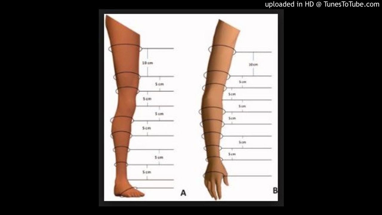 Evaluation Of Lymphedema In Upper Extremities By Mr Lymphangiography Comparison With