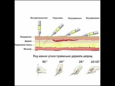 КАК СТАВЯТ УКОЛЫ..ТЕХНИКА НАГЛЯДНО #зож #здоровье #польза #shortvideo # ...