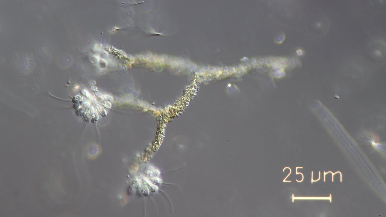 Anthophysa vegetans, a colorless Chrysophyceae - YouTube