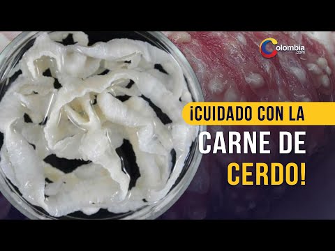 La enfermedad que se produce por comer carne de cerdo mal cocida