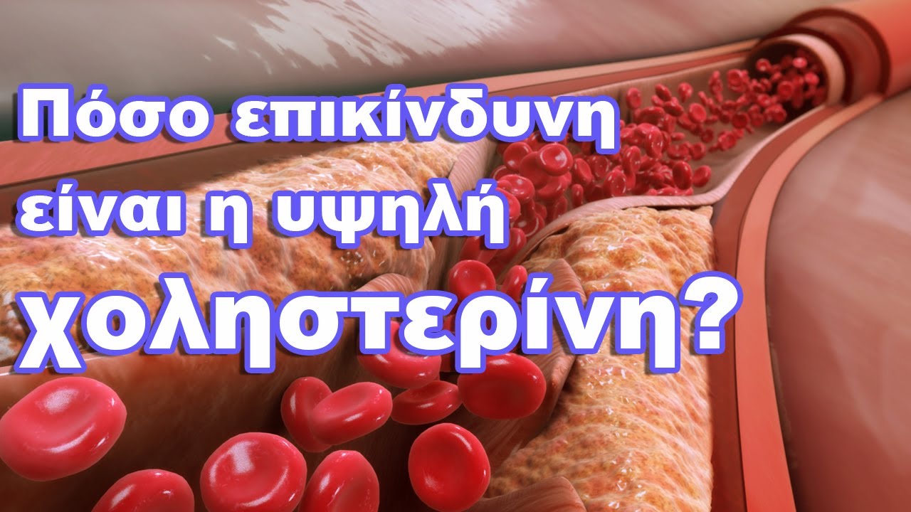 (GK) 🔍 Τι είναι η χοληστερόλη; Μάθετε τα πάντα για το LDL & HDL τώρα! 💡 ...
