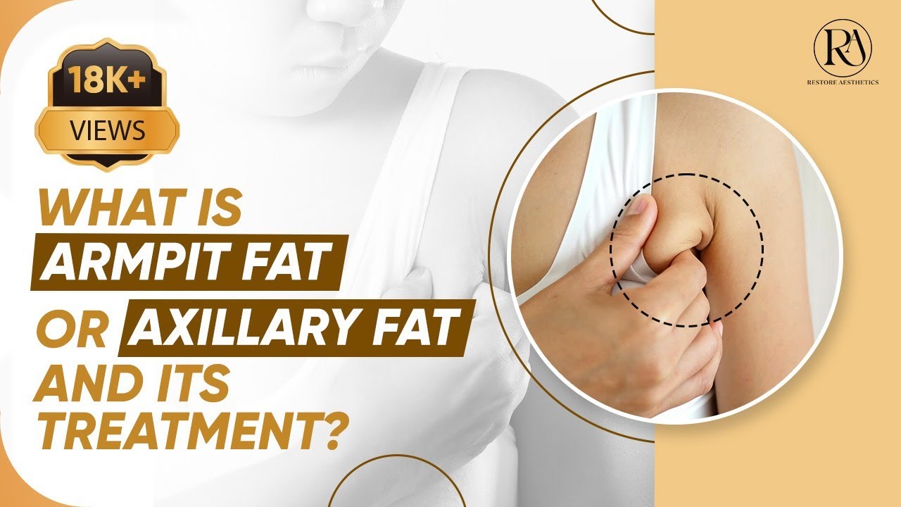 Armpit Fat Removal Surgery: Underarm Liposuction for Axillary Breast ...