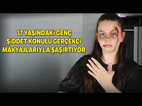 Onu Gören, Çığlık Atıp Ambulansı Arıyor