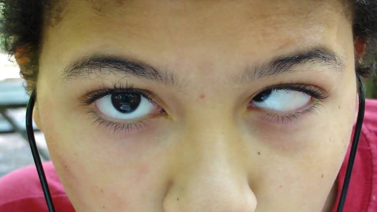 The Colby Chronicles: Eye Swapping , autism - YouTube