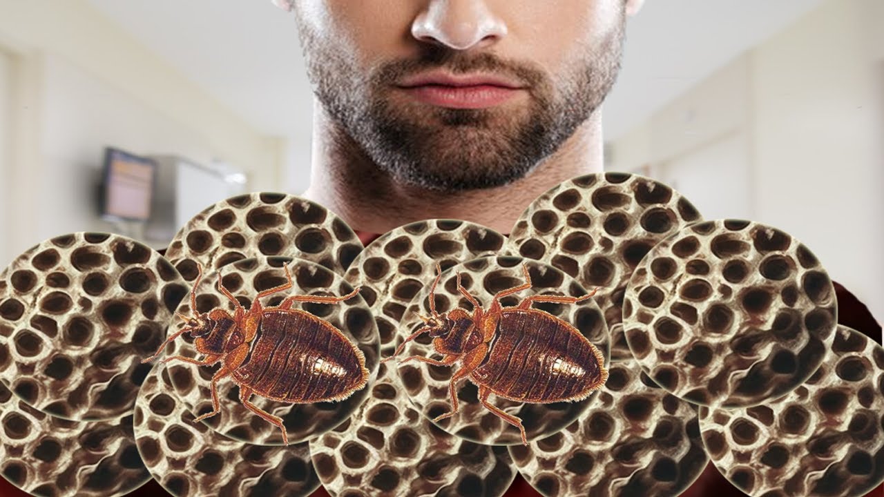 ASMR Remove dog ticks & Trypophobia Infected neck | ASMR Animation ...